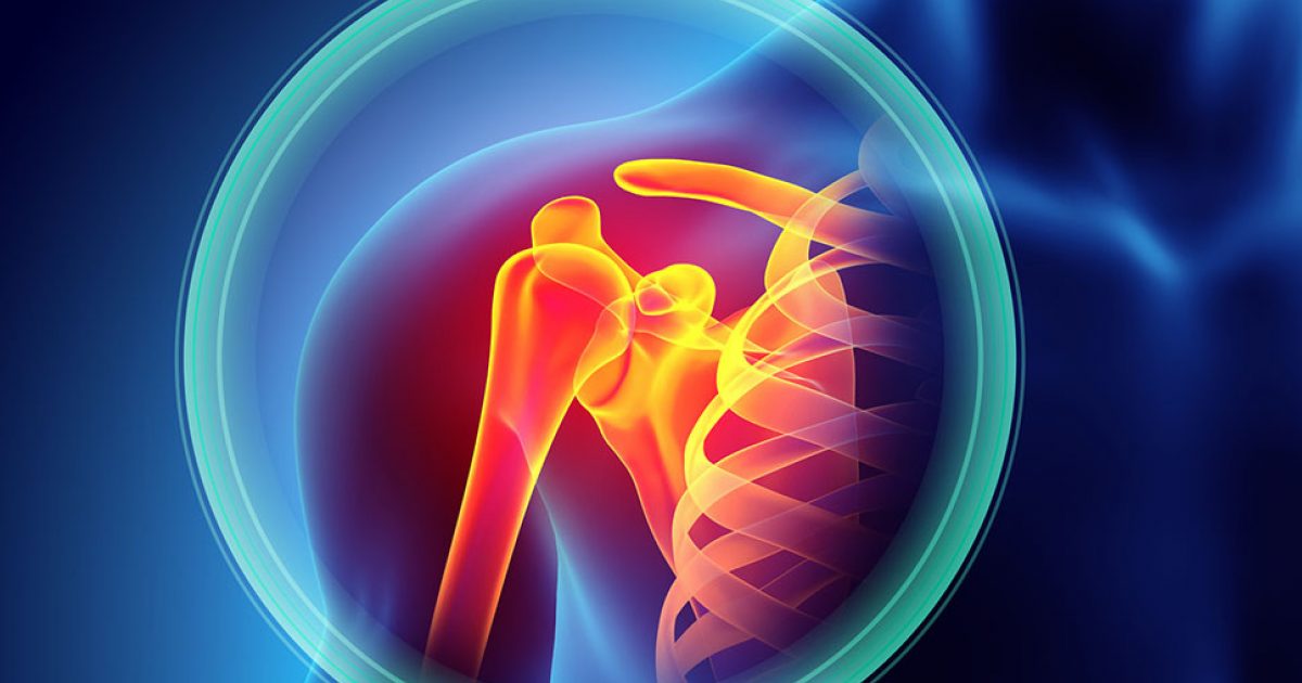 Clinical Approach to Pediatric Shoulder Injuries | Clinician.com