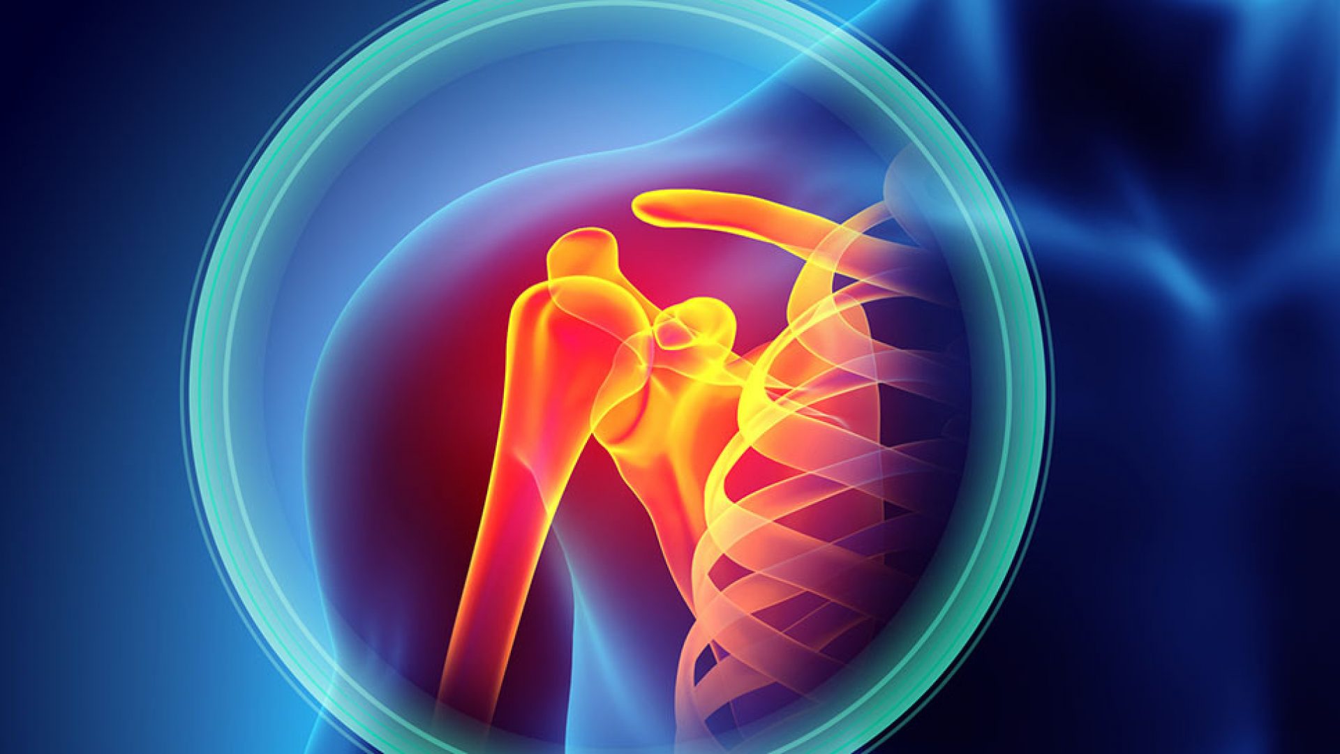 Clinical Approach to Pediatric Shoulder Injuries | Clinician.com