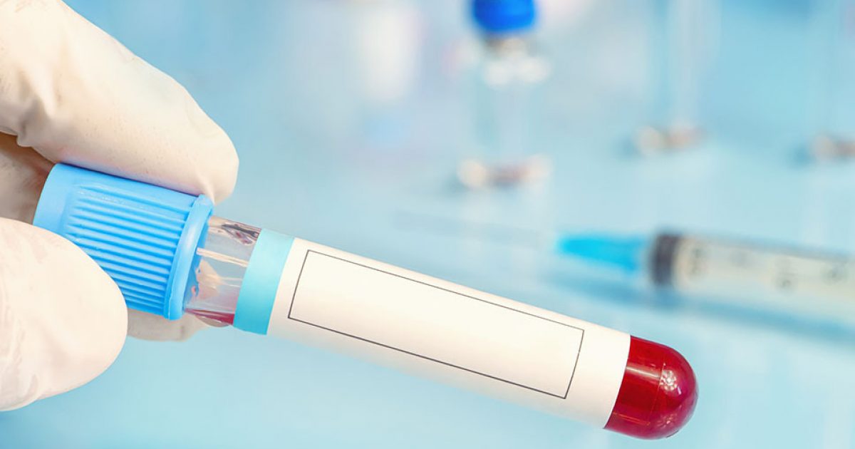 Contaminated Pediatric Blood Cultures | Clinician.com