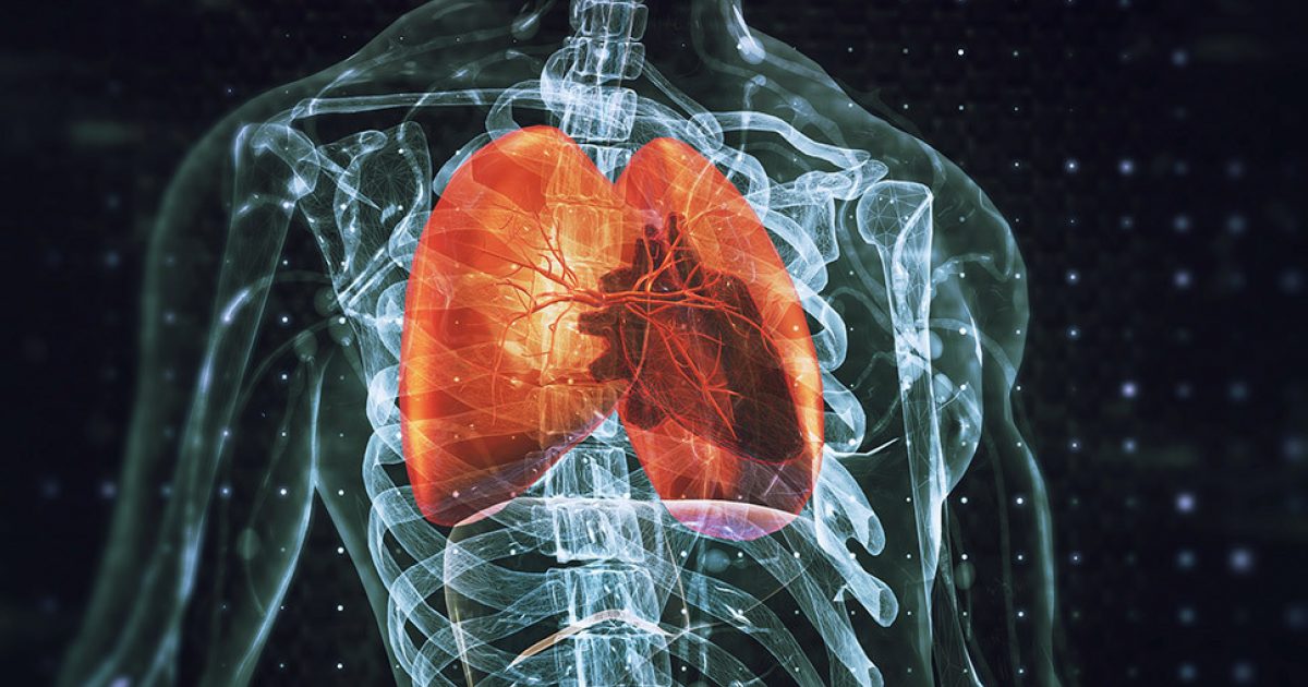 Does Thoracentesis Speed Recovery from Heart Failure? | Clinician.com