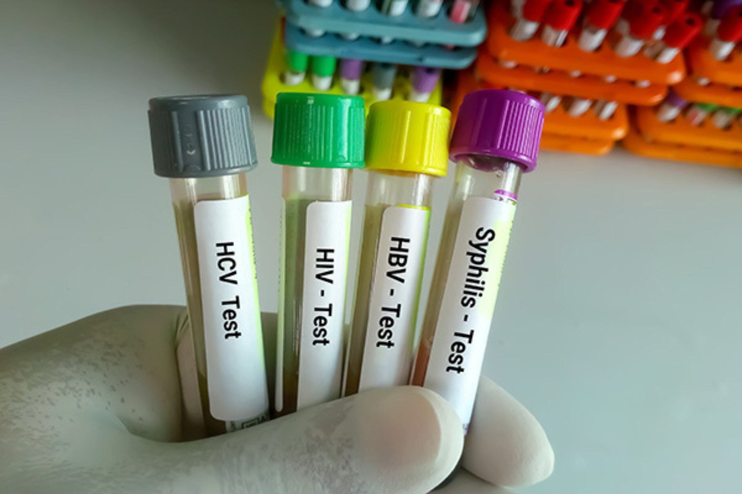 Doxycycline Demonstrates Protection Against Sexually… | Clinician.com