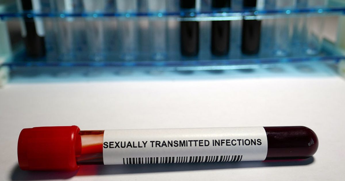 Effects of Federal Cuts to STI Programs Could Be… | Clinician.com
