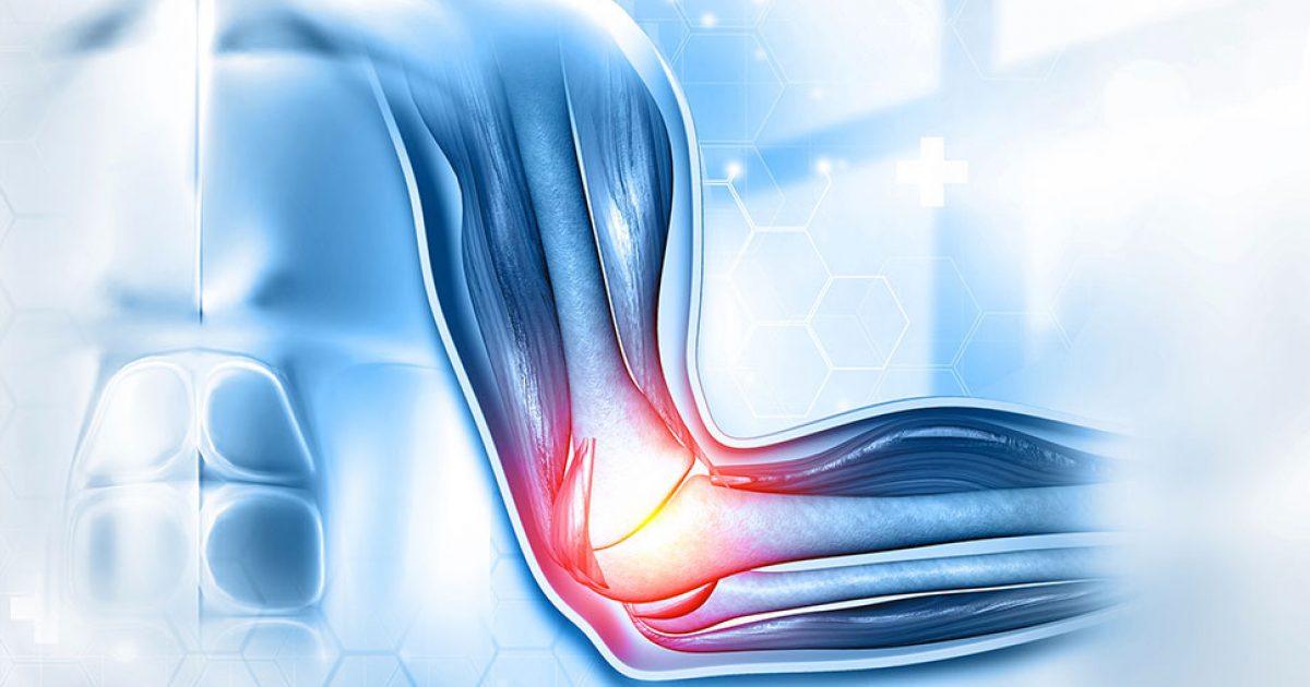 Evaluation and Management of Elbow Injuries in the… | Clinician.com
