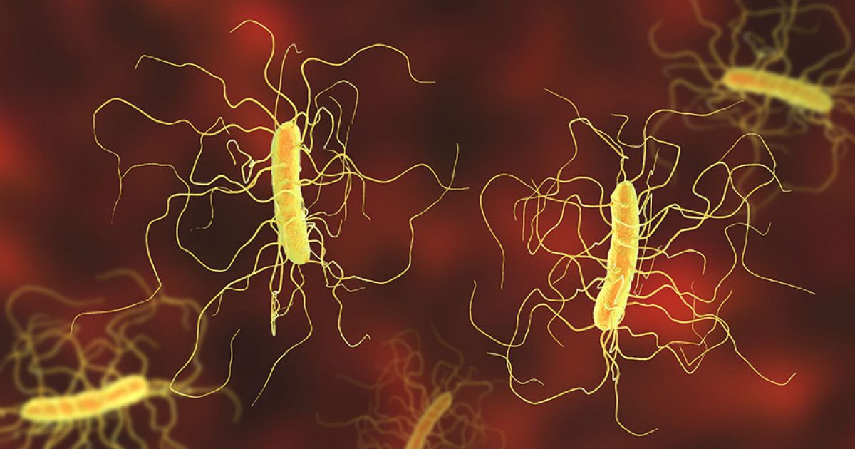 Fecal Microbiota Transplant as First-Line Therapy for… | Clinician.com