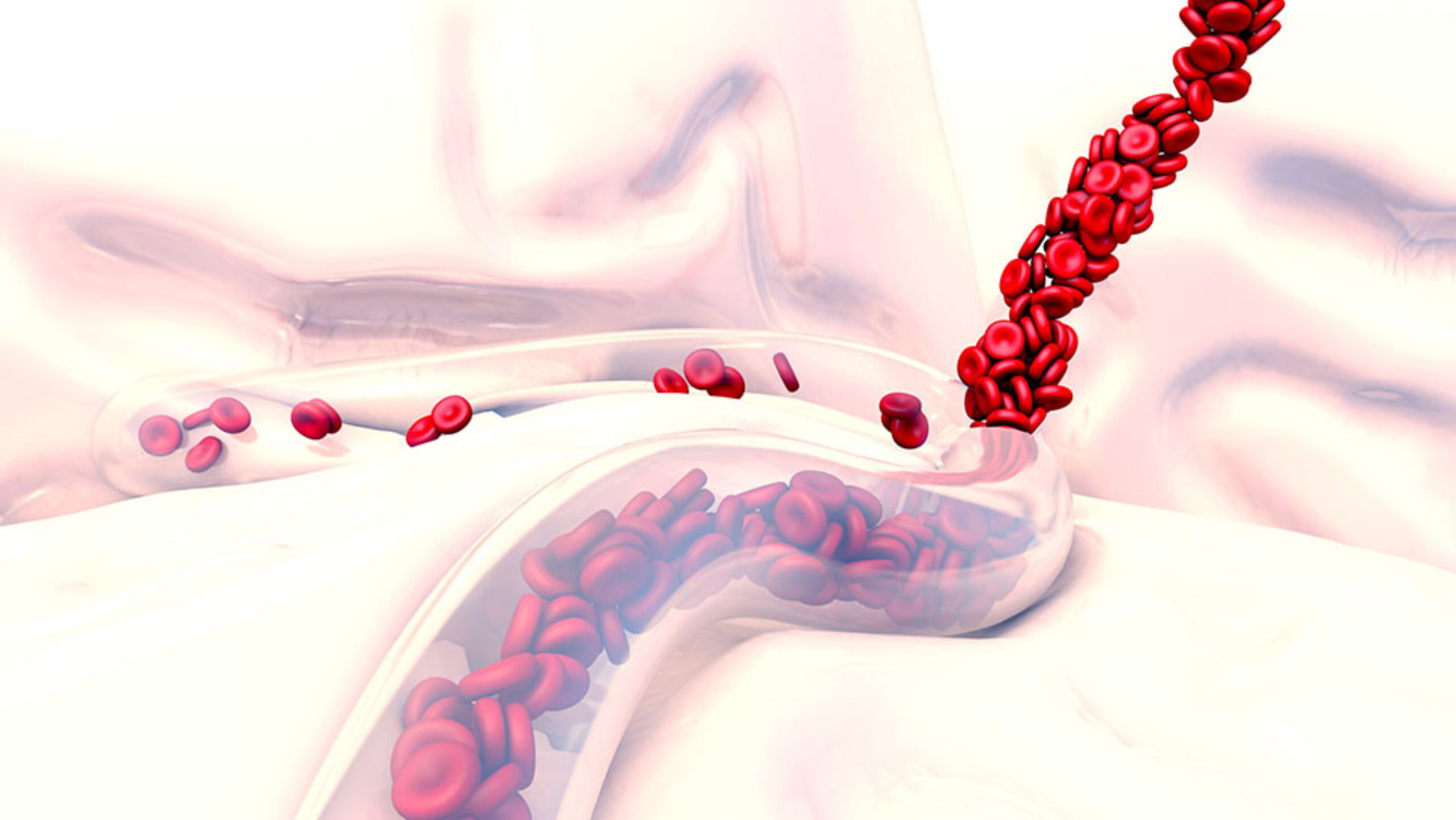 Hemorrhage Control in Adult and Geriatric Trauma | Clinician.com