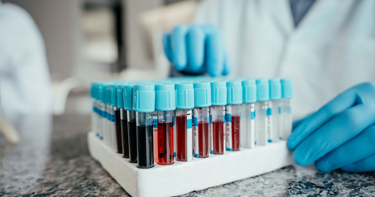 Moldy Bloodstream Infections | Clinician.com
