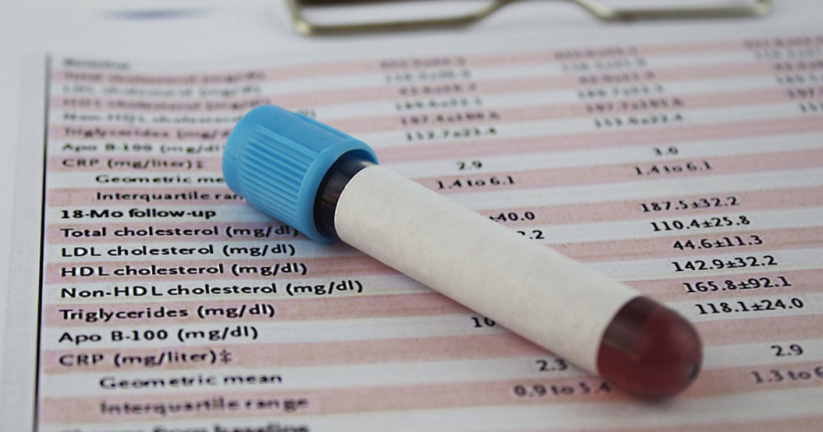 New Injectable Cholesterol-Lowering Drug Trial | Clinician.com