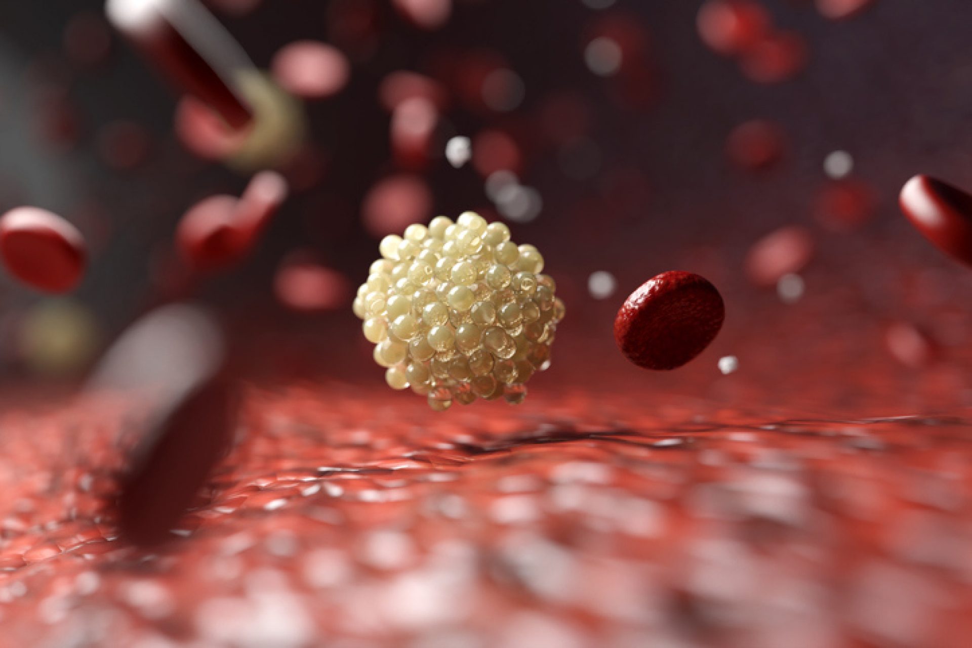 Olezarsen Injection (Tryngolza) | Clinician.com