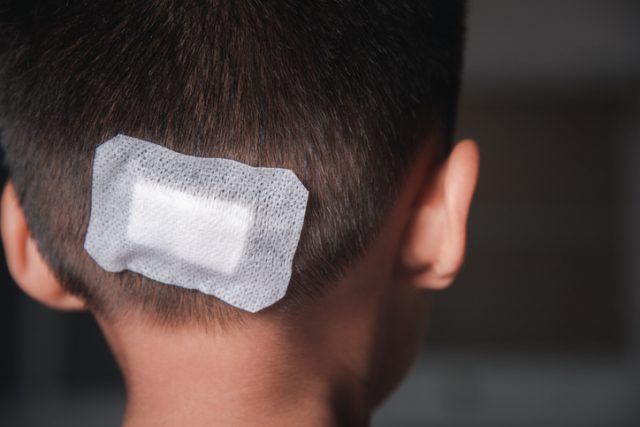 Managing Pediatric Wounds | Clinician.com