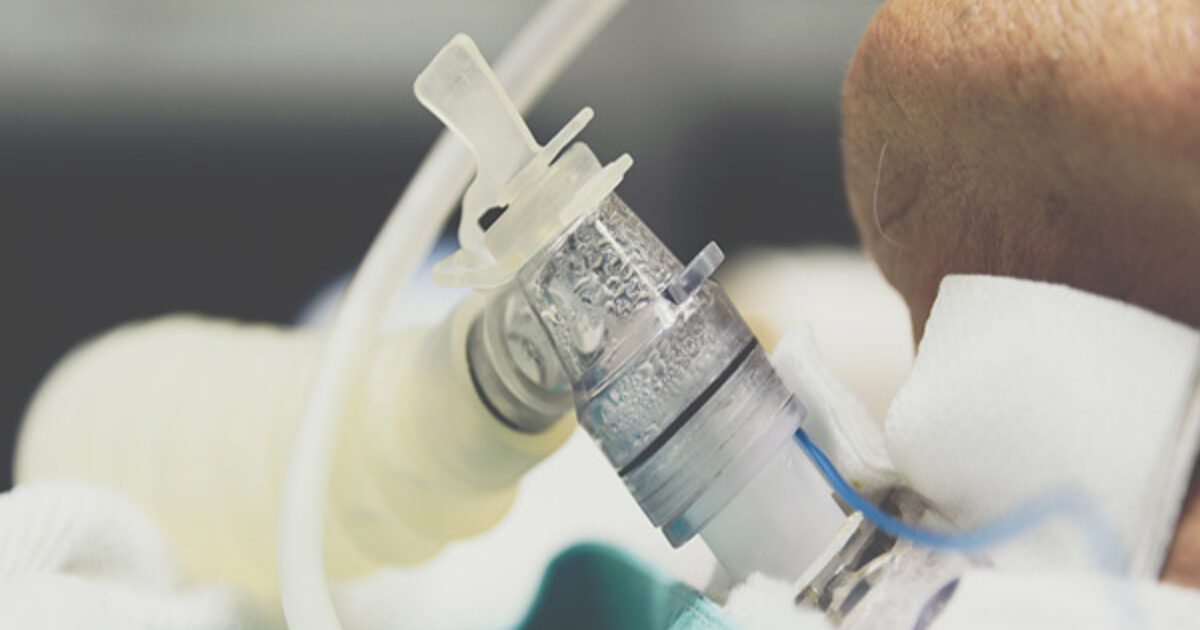 Novel Bedside Procedure Improves Tracheostomy Outcomes | Clinician.com