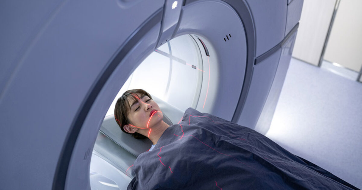 Incidental Cerebral Microinfarcts in Patients with… | Clinician.com