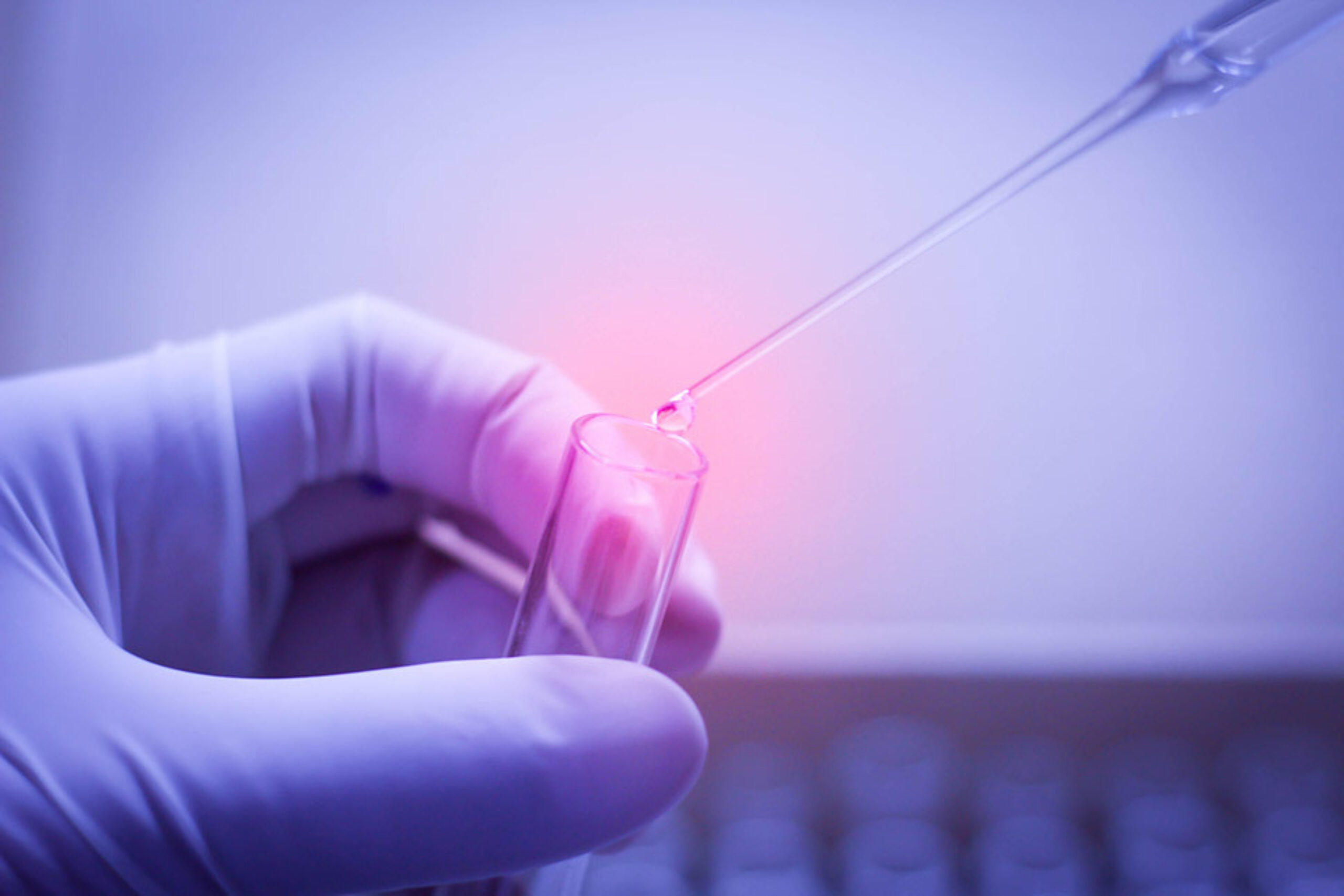 The Clinical Spectrum of Anti-GQ1b Antibody Syndrome | Clinician.com