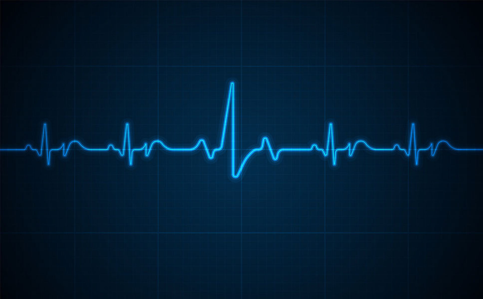 What Are Those T Waves Relias Media