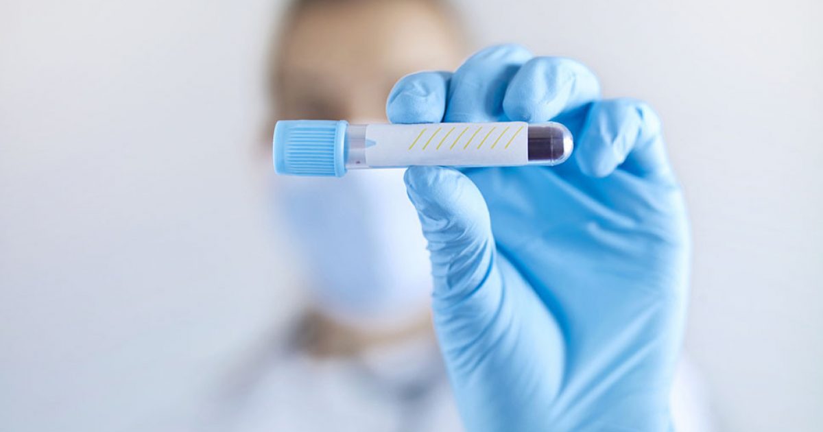 What Is New with Leptospirosis? | Clinician.com