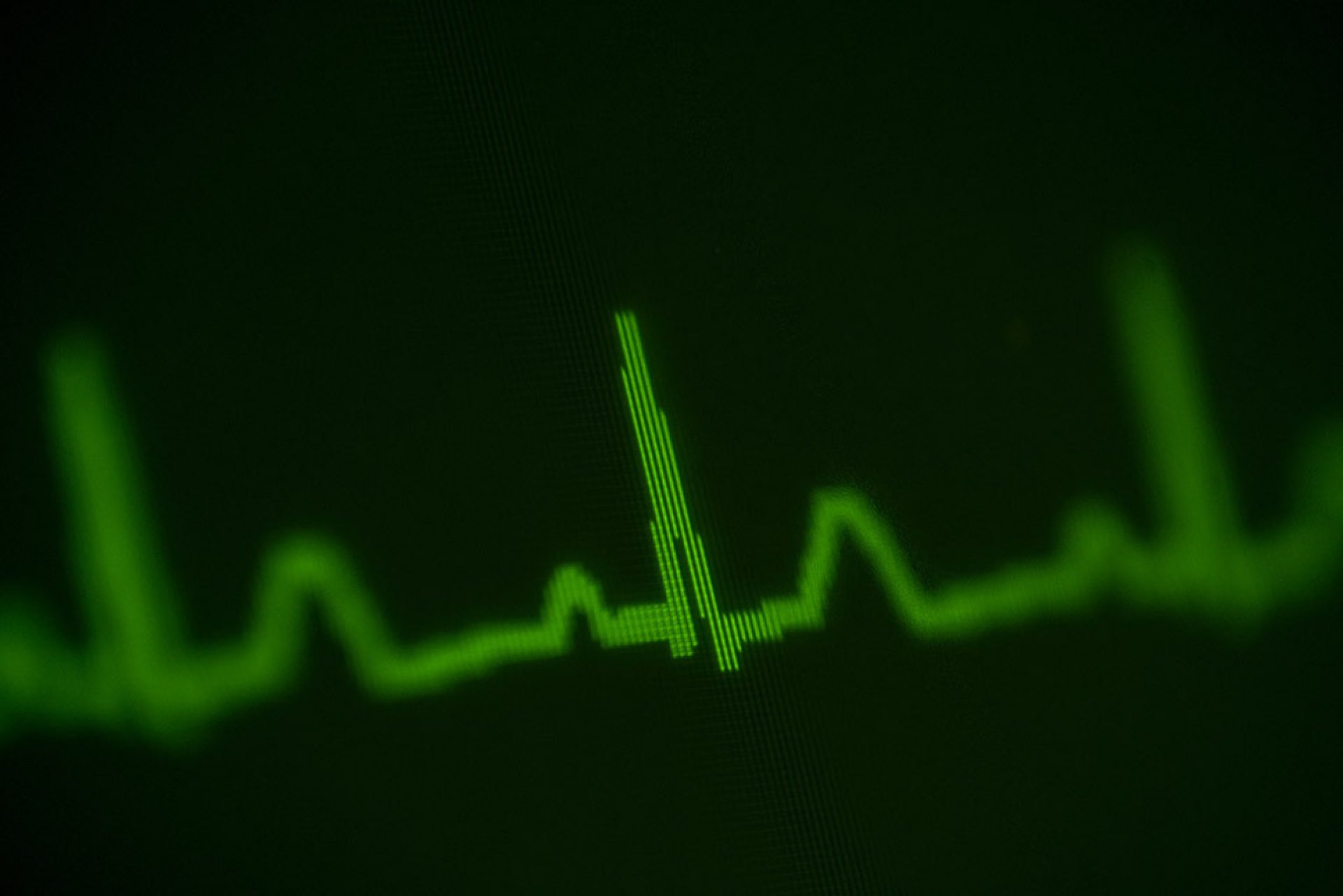 Withdrawing Heart Failure Medications After Restoring… | Clinician.com