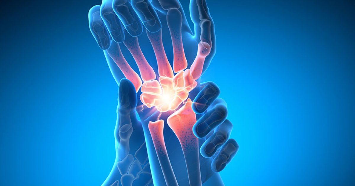 Wrist and Finger Dislocations | Clinician.com