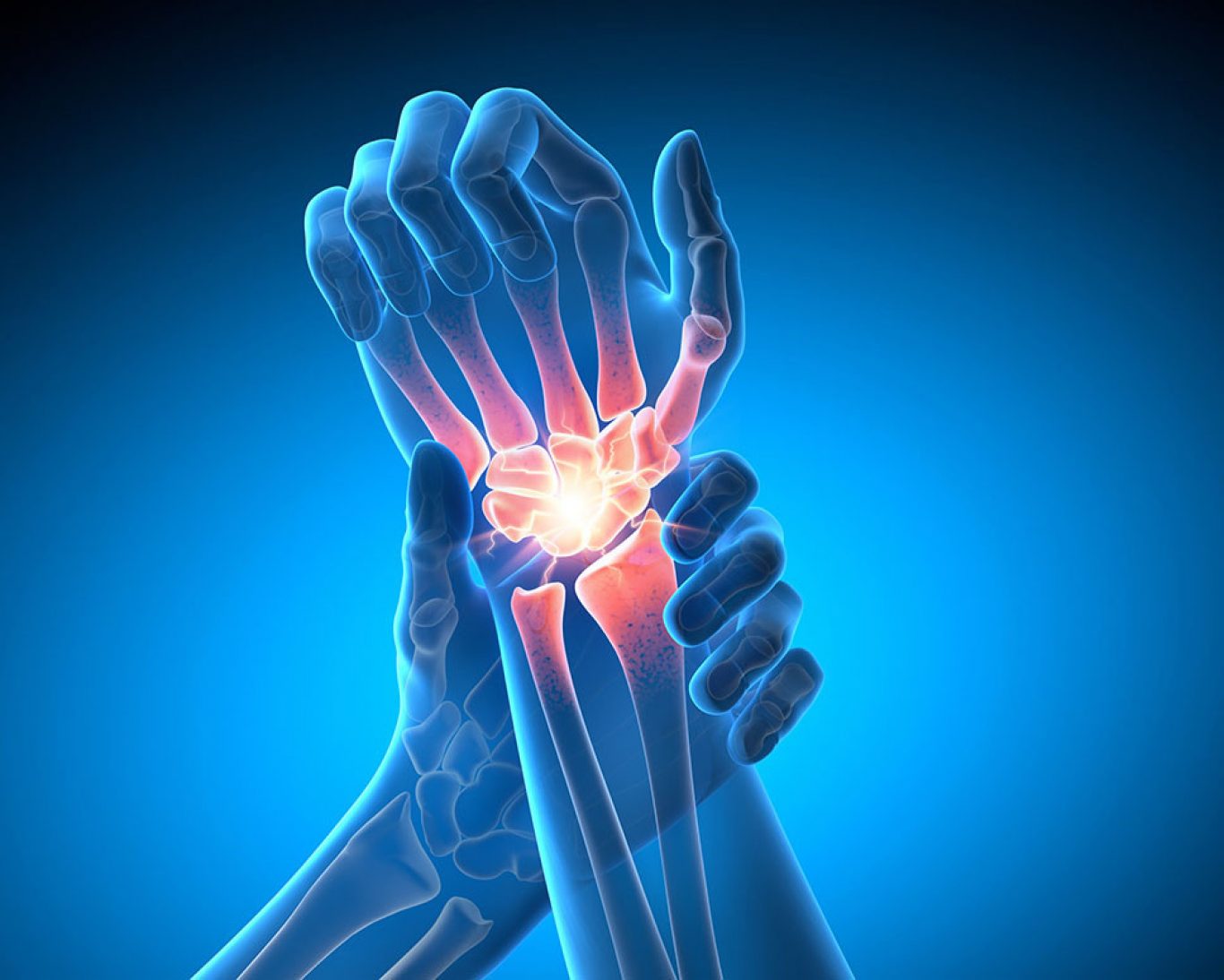 Wrist and Finger Dislocations | Clinician.com