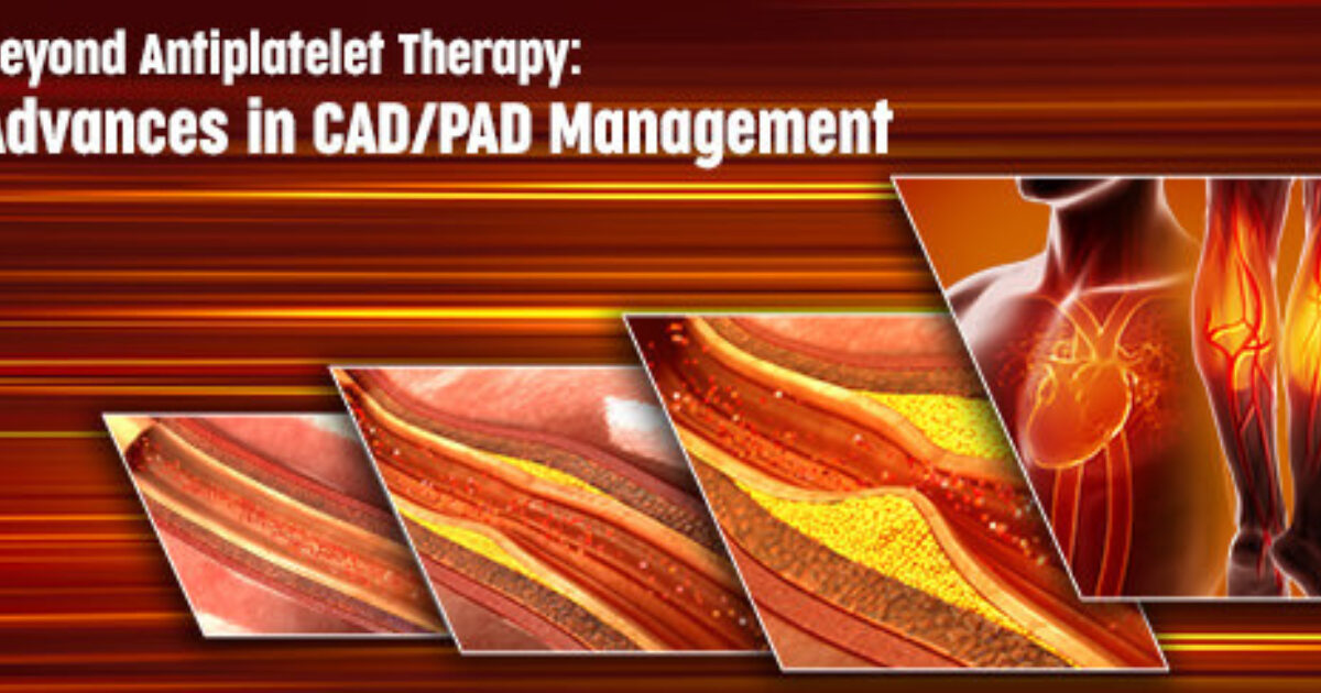 Beyond Antiplatelet Therapy: Advances in CAD/PAD… | FreeCME.com