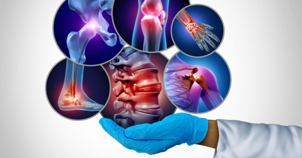 Race and Gender Considerations in RA Management | FreeCME.com